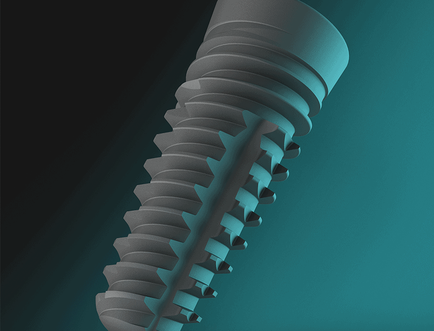 Patients from Out of Town | NQ Surgical Dentistry Townsville